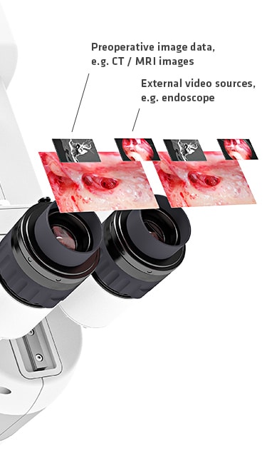 Munich Surgical Imaging – The ARRISCOPE is the world’s first high ...