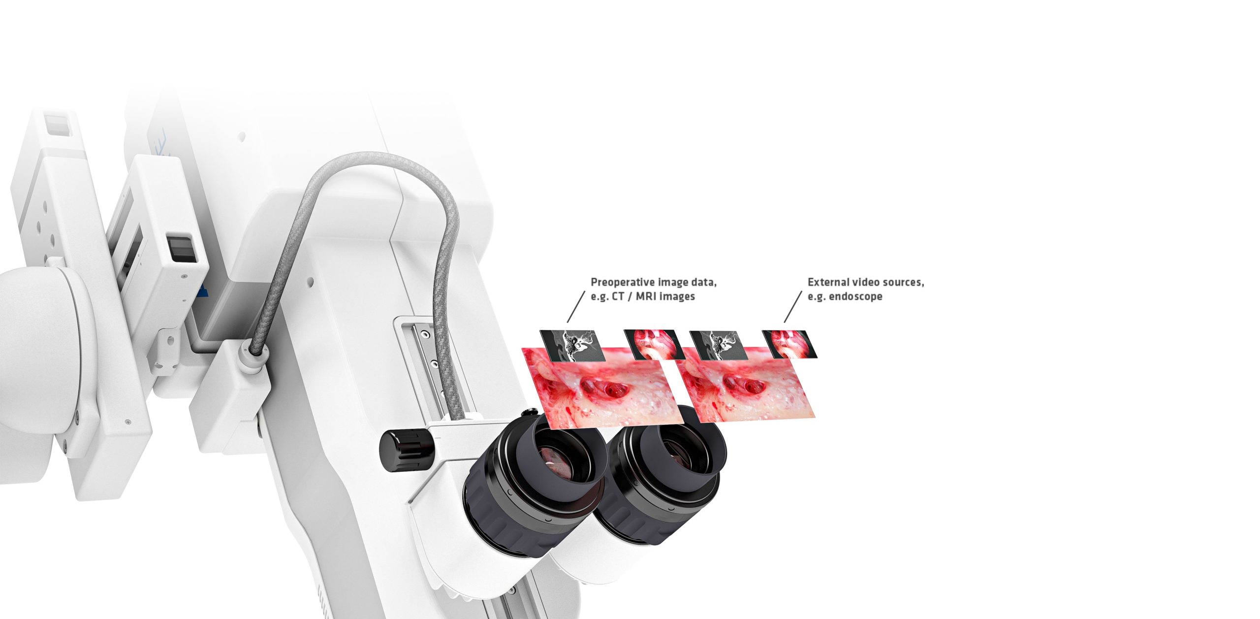 Munich Surgical Imaging – The ARRISCOPE is the world’s first high ...